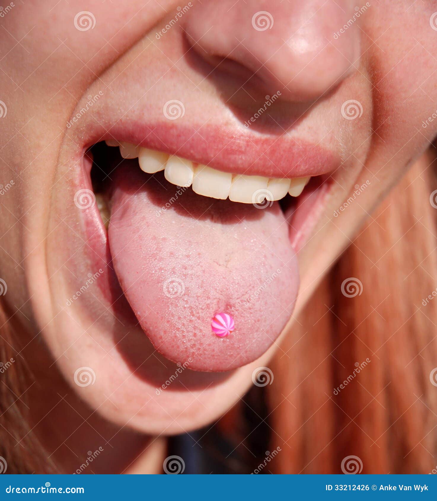 Tongue Ring Gone Wrong
