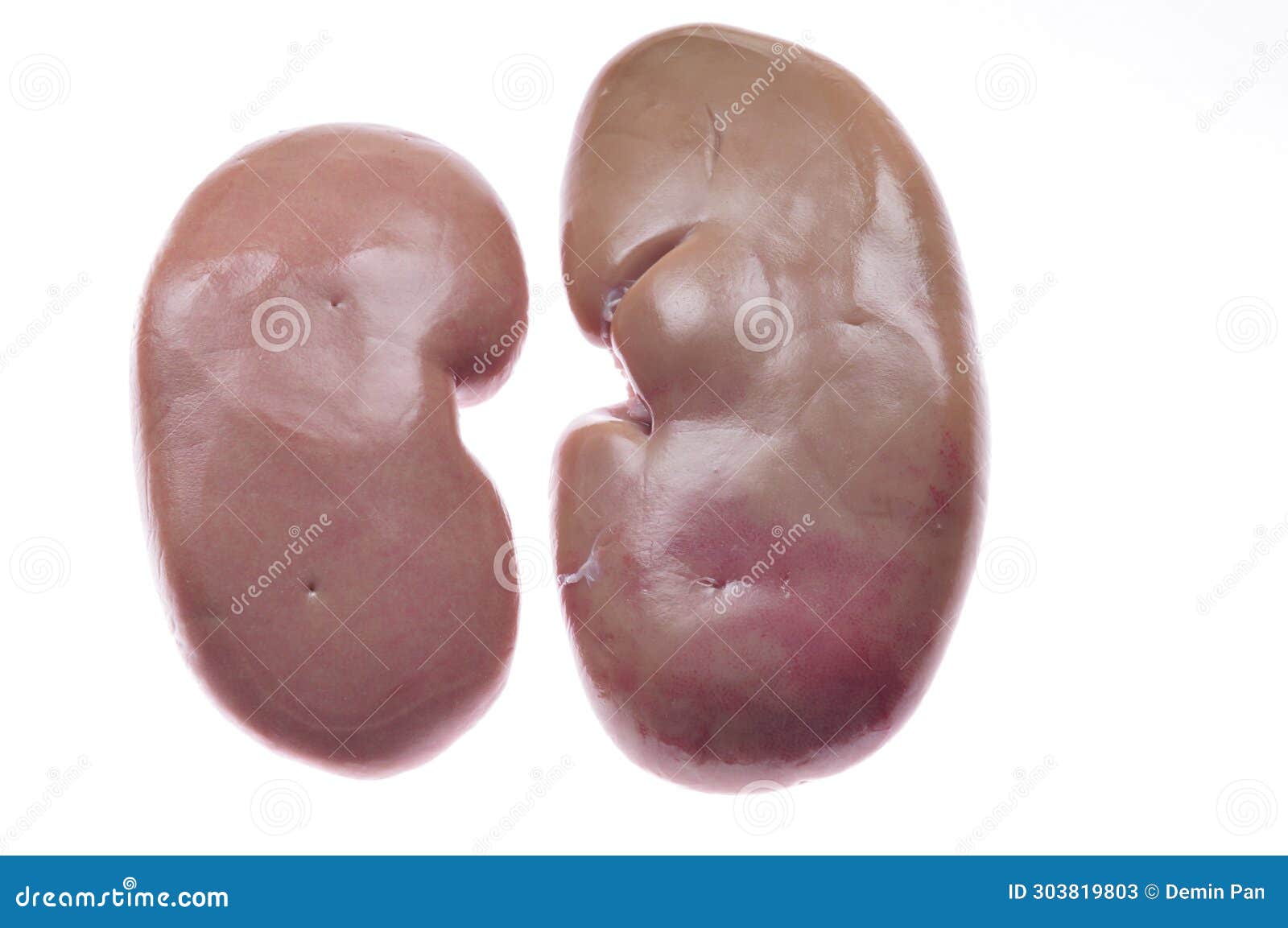 Pig Kidney on a White Background Stock Image - Image of medicine ...