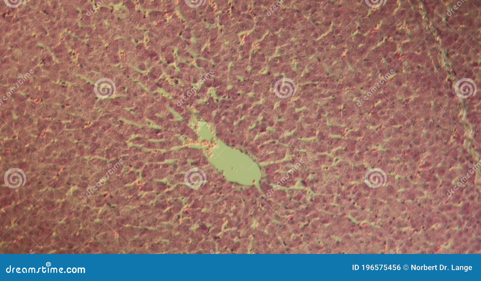 Pig liver tissue stock footage. Video of pain, doctor - 196575456