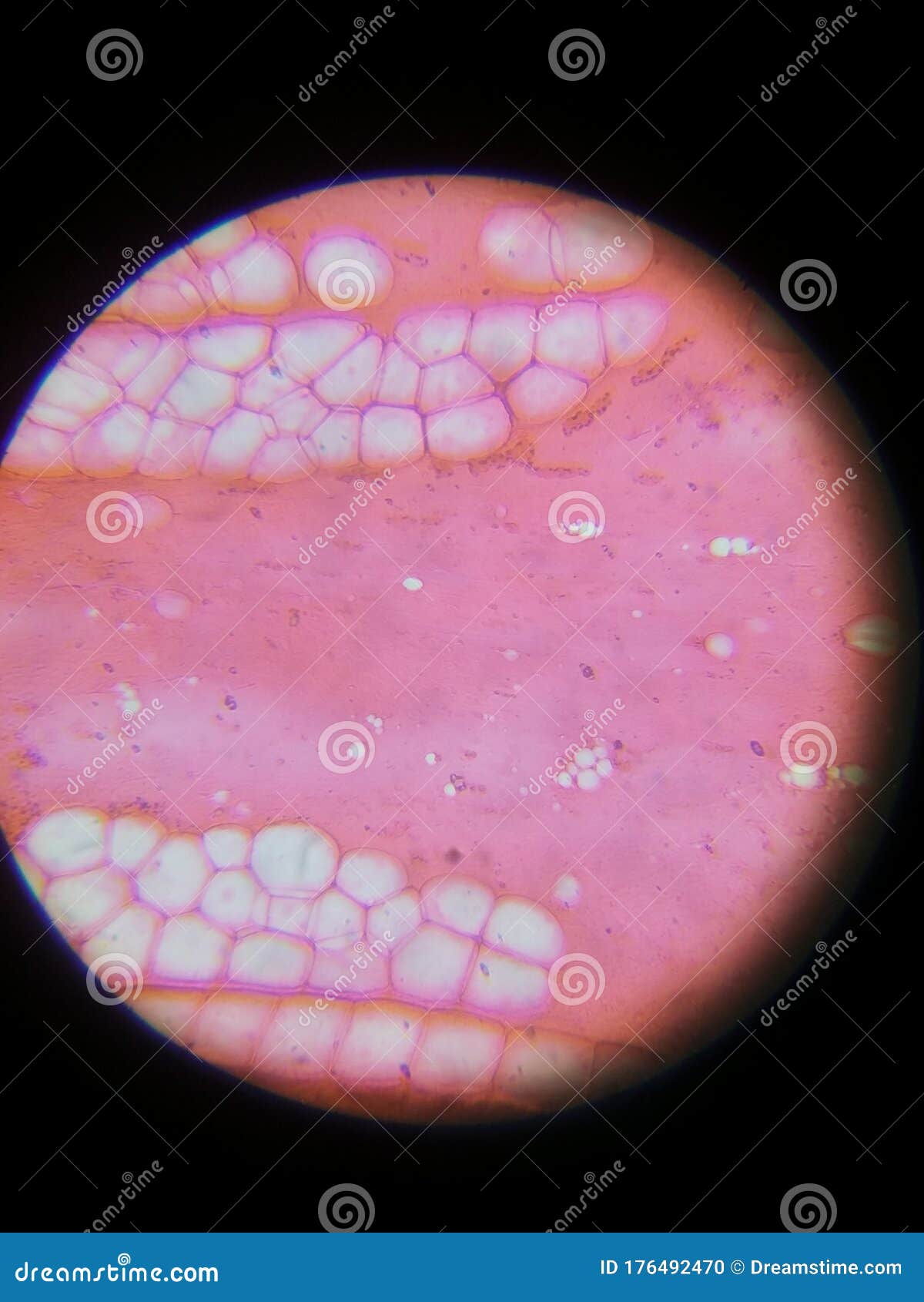 .Pig Skin Under a Microscope Stock Photo - Image of microscope, skin ...