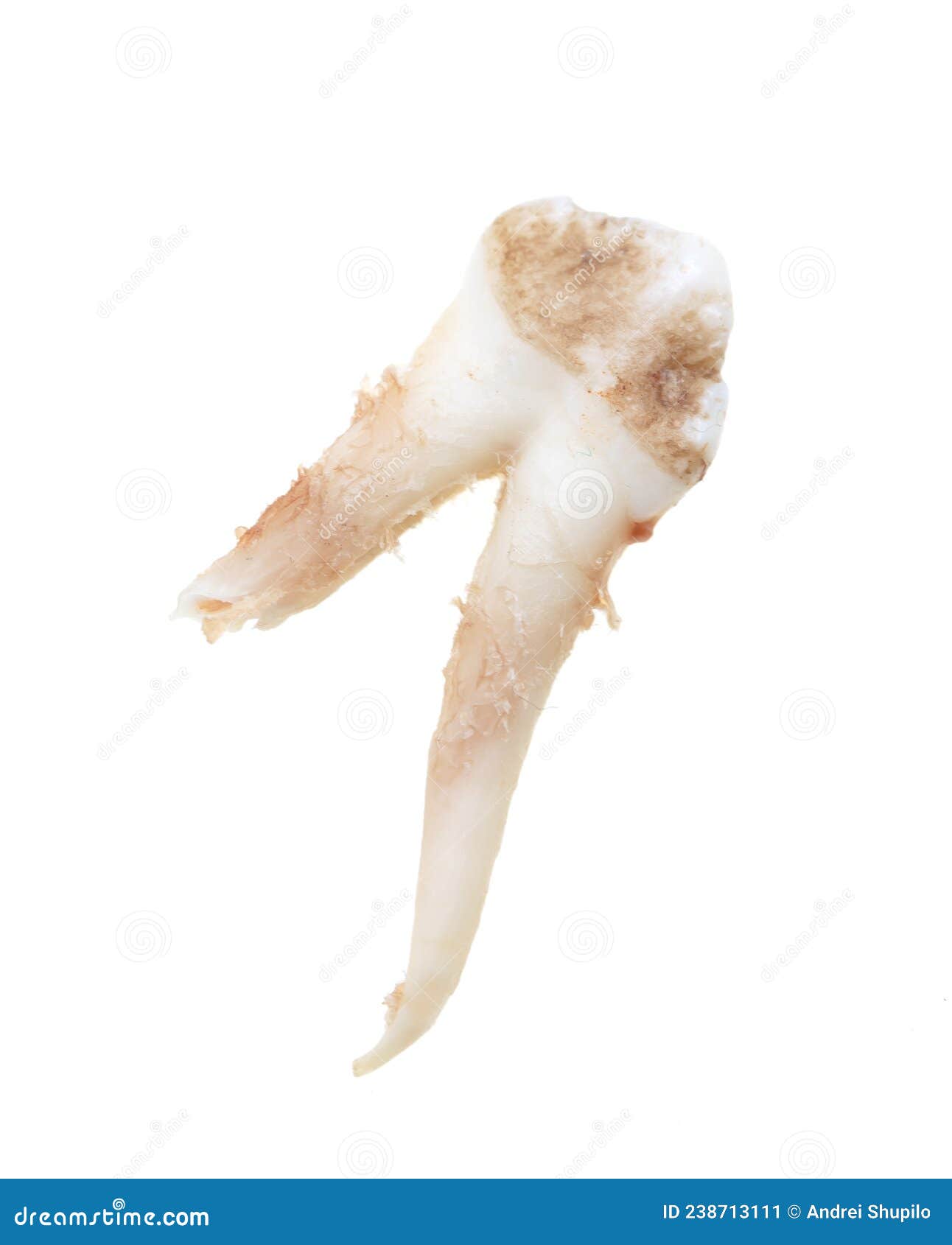 Pig Teeth Isolated on a White Background. Stock Image - Image of femur ...