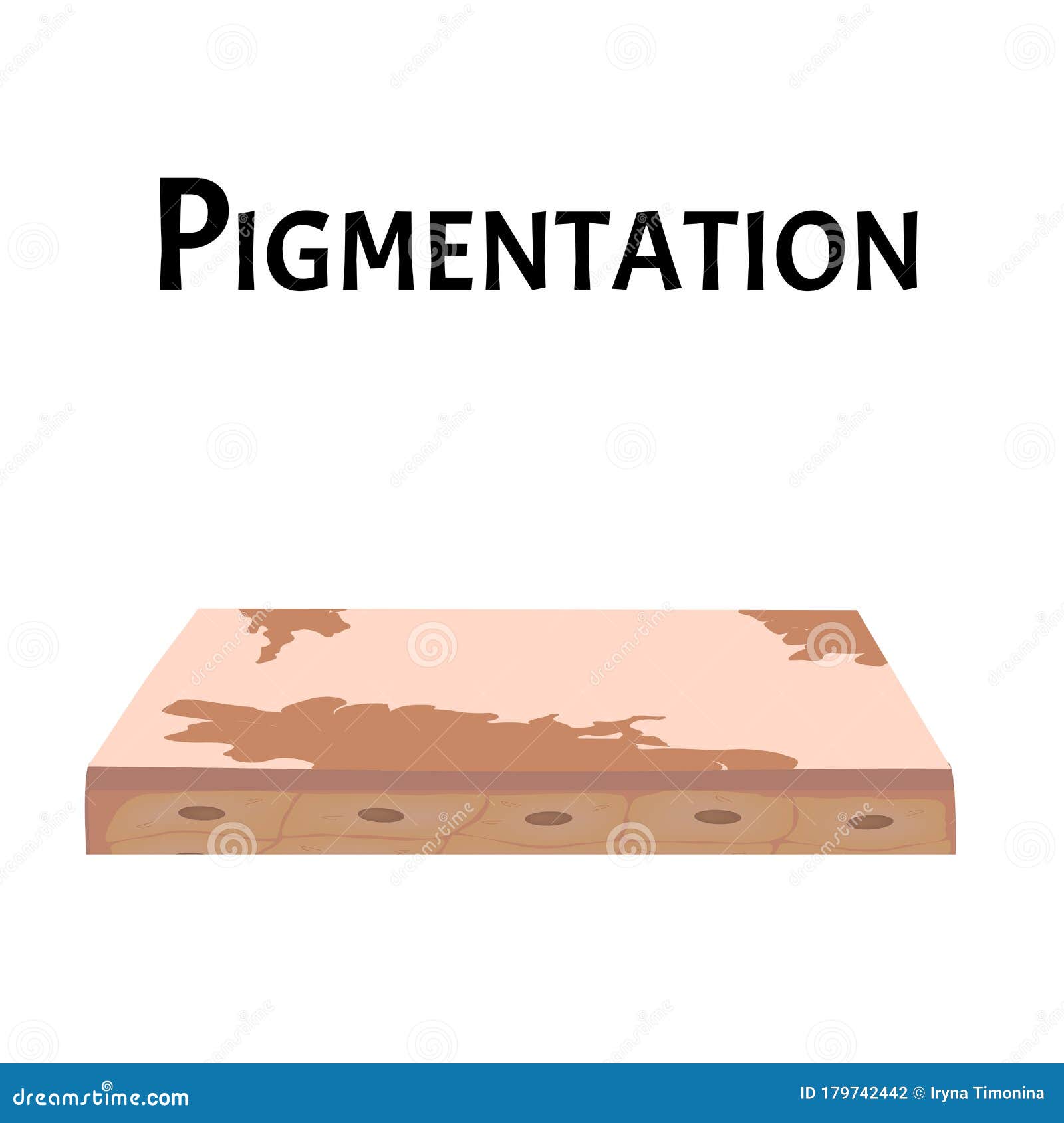Pigmentation on the Skin. a Pigmented Spot on the Skin of the Face ...