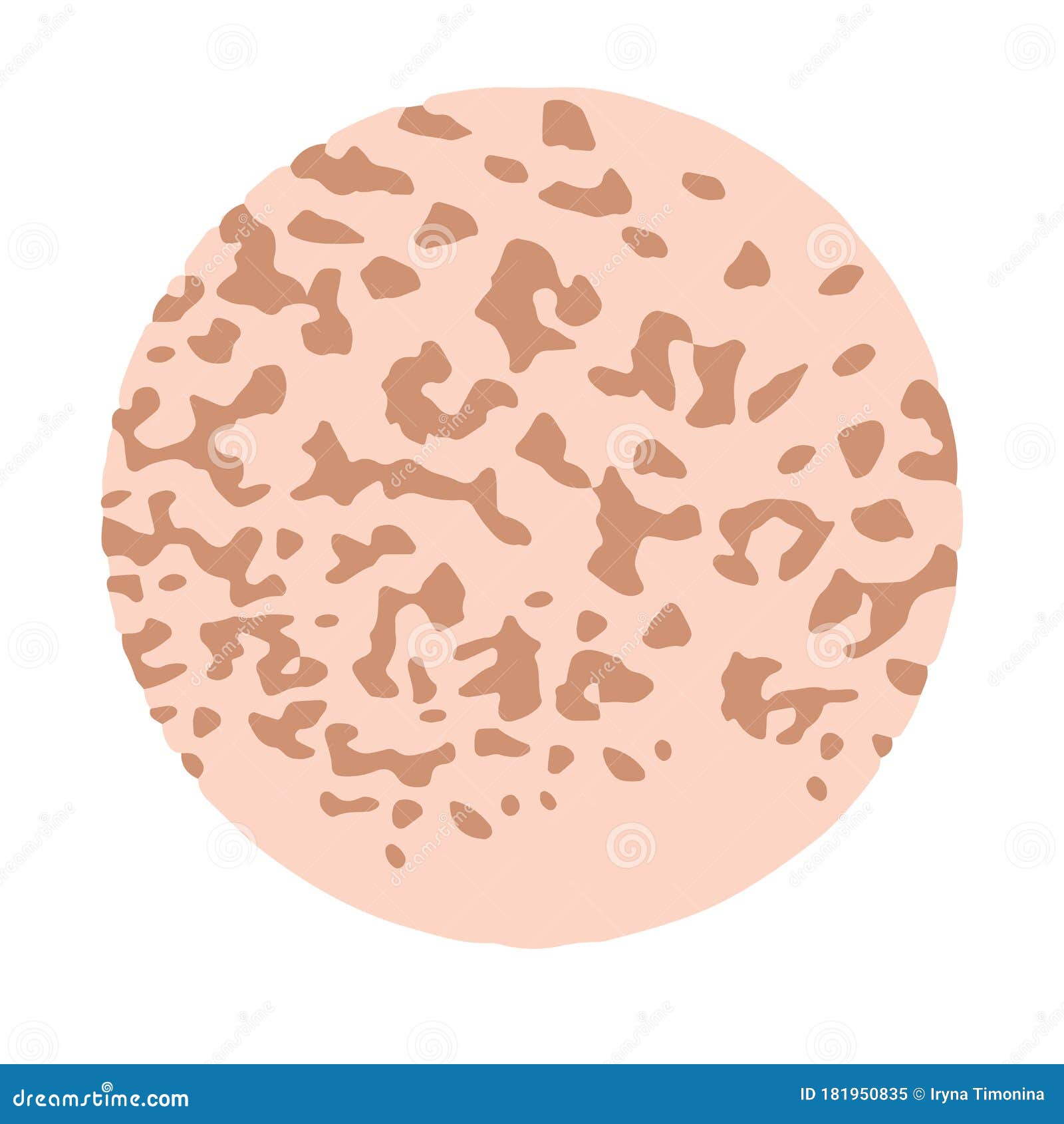 Pigmentation on the Skin. a Pigmented Spot on the Skin of the Face ...