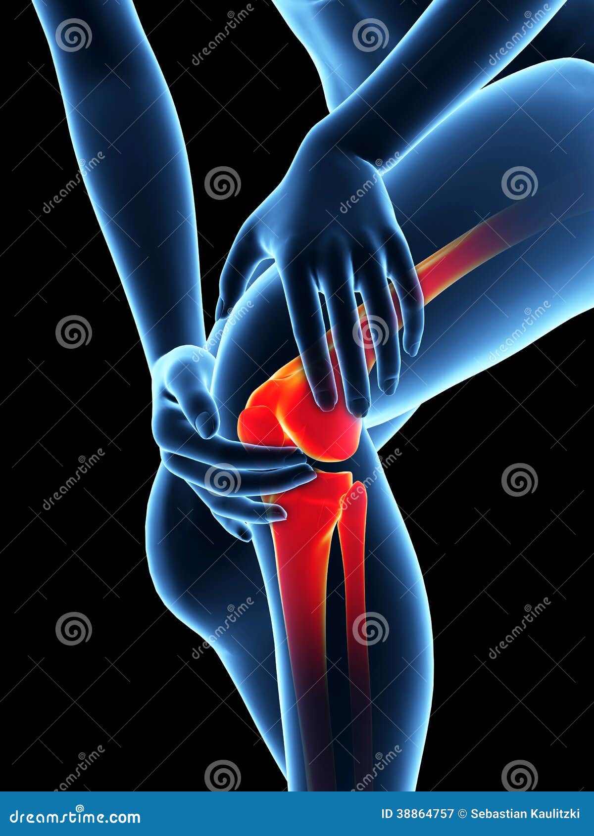 Pijn in de knie stock illustratie. Illustration of pijnlijk - 38864757