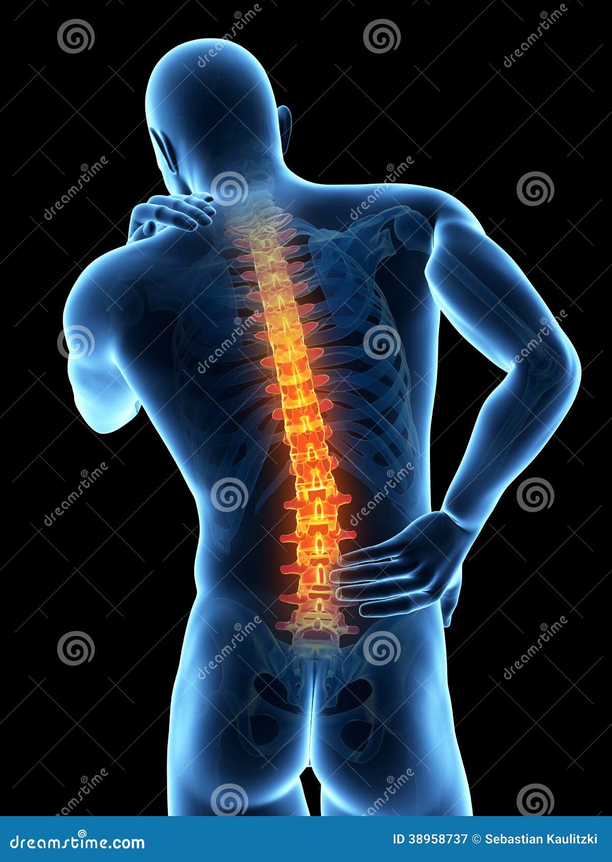 Pijn in de rug stock illustratie. Illustration of gekwetst - 38958737