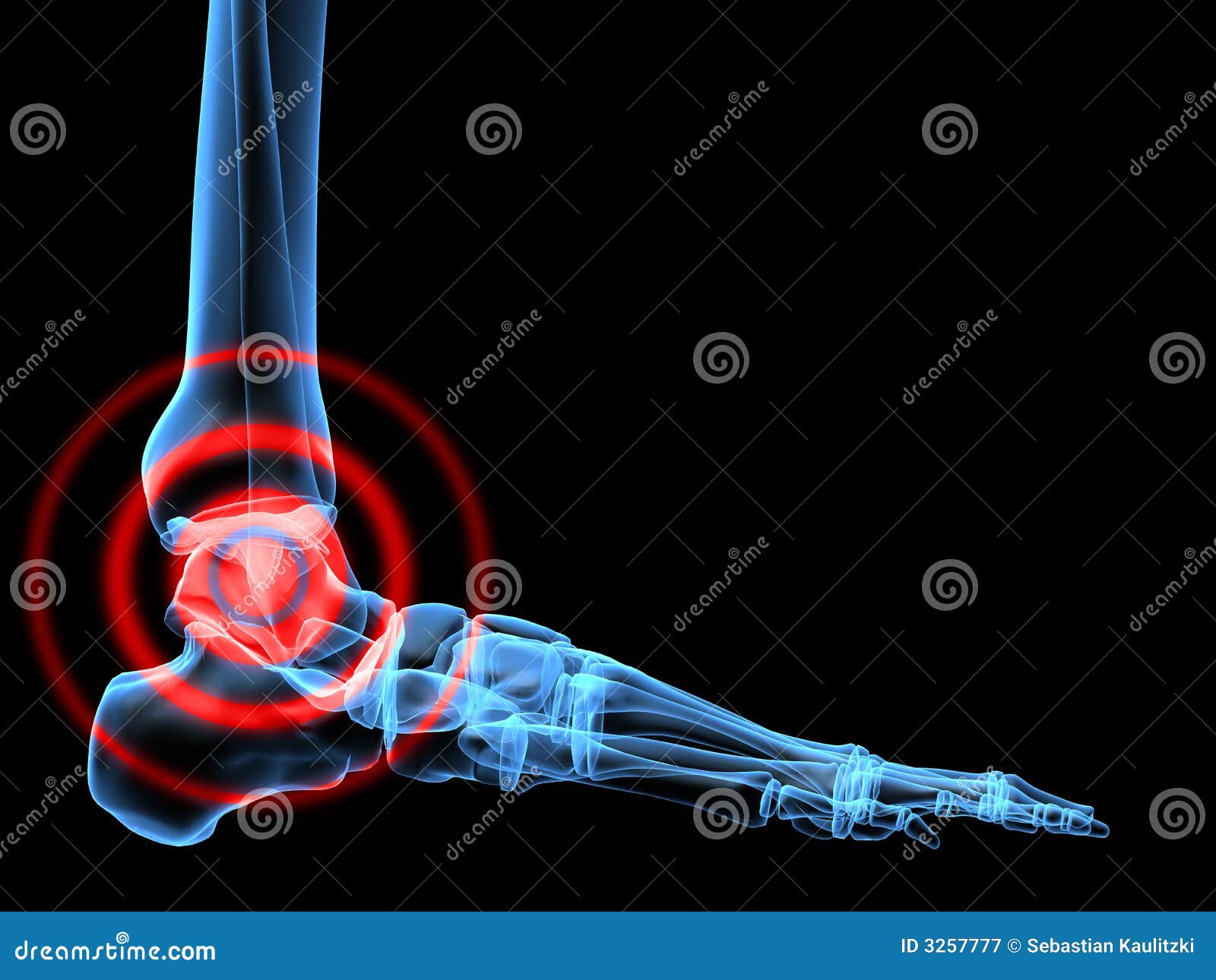 Pijn in enkel stock illustratie. Illustration of pijn - 3257777