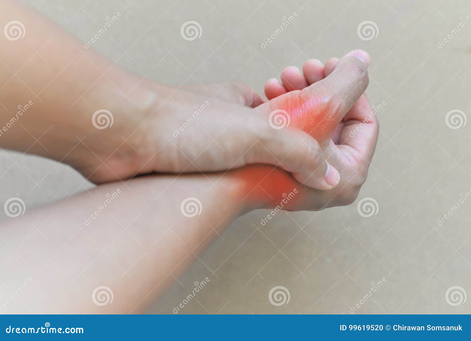 Pijnlijke En Ontstoken Jicht Stock Foto - Image of begrip, mensen: 99619520