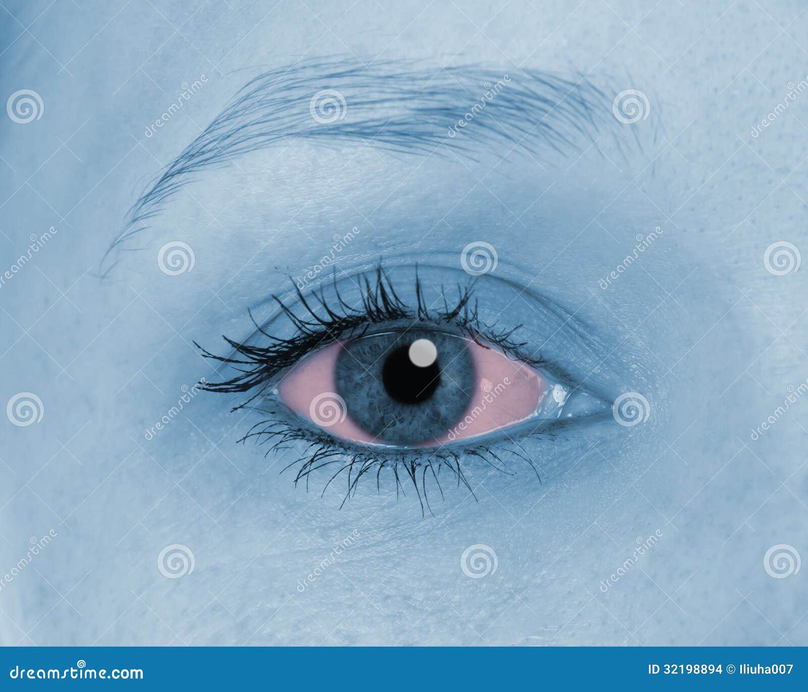 Pijnlijke Ogen, Getoond Rood Stock Foto - Image of soort, bezinning ...