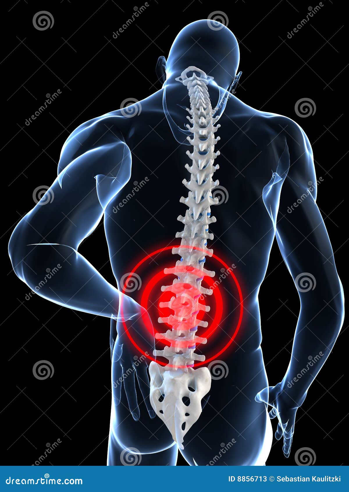 Pijnlijke rug stock illustratie. Illustration of ribben - 8856713