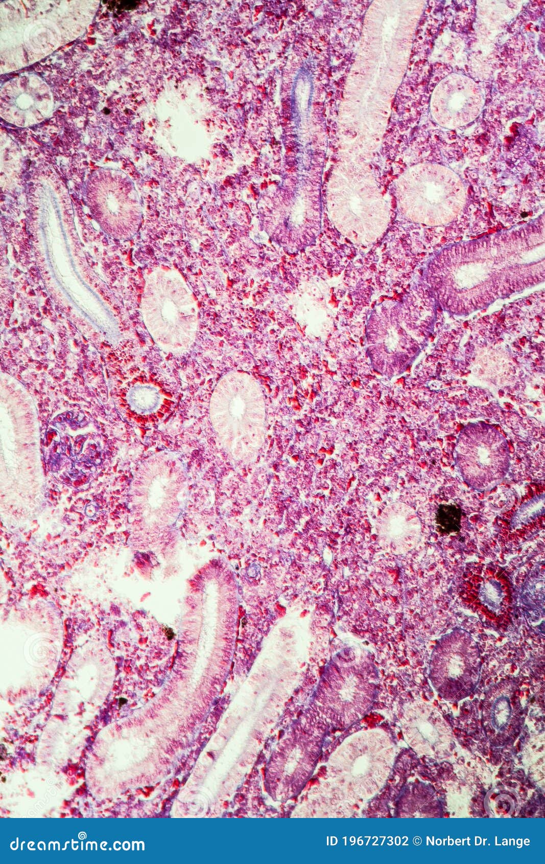 Pike Kidney in Cross Section Stock Photo - Image of science ...