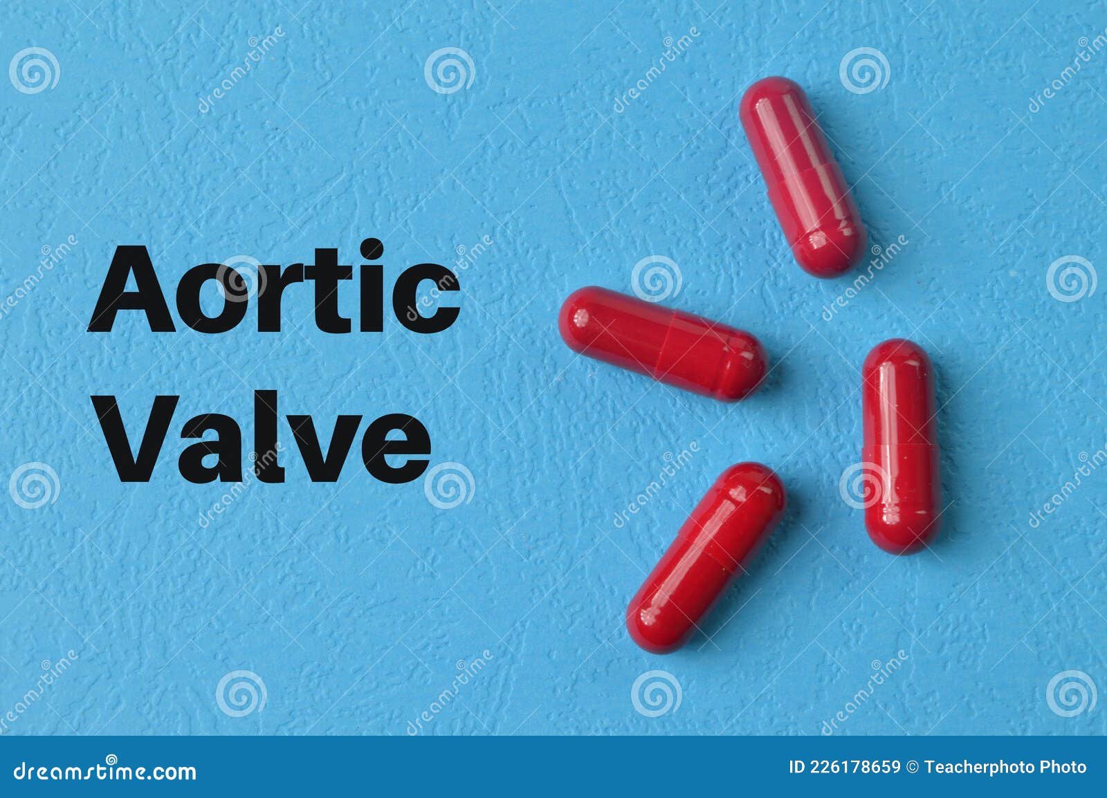 Aortic Regurgitation: Blood Flow Dynamics In The Heart - Medical ...