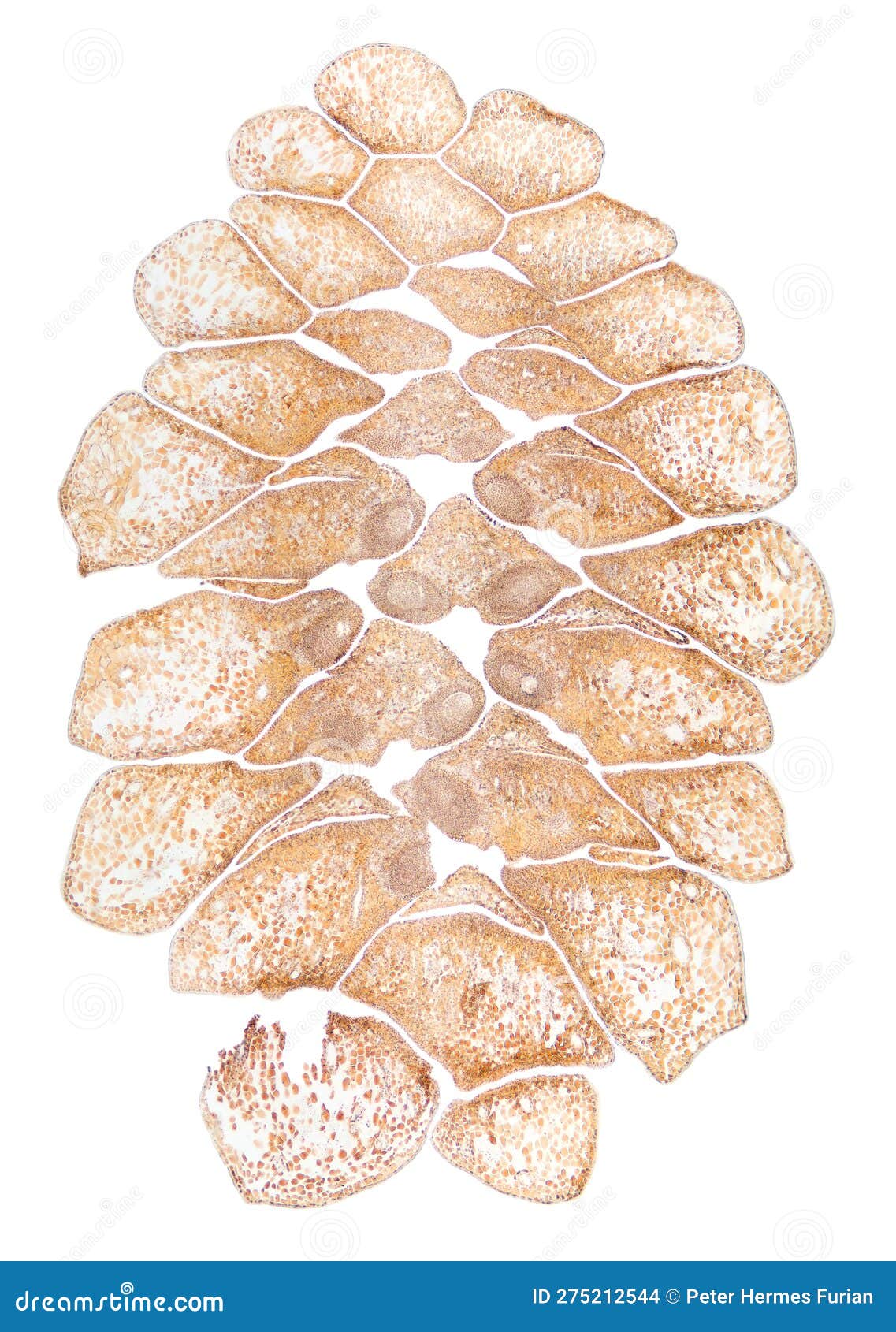 Light Micrograph And Illustration Of Ovary | CartoonDealer.com #78472740
