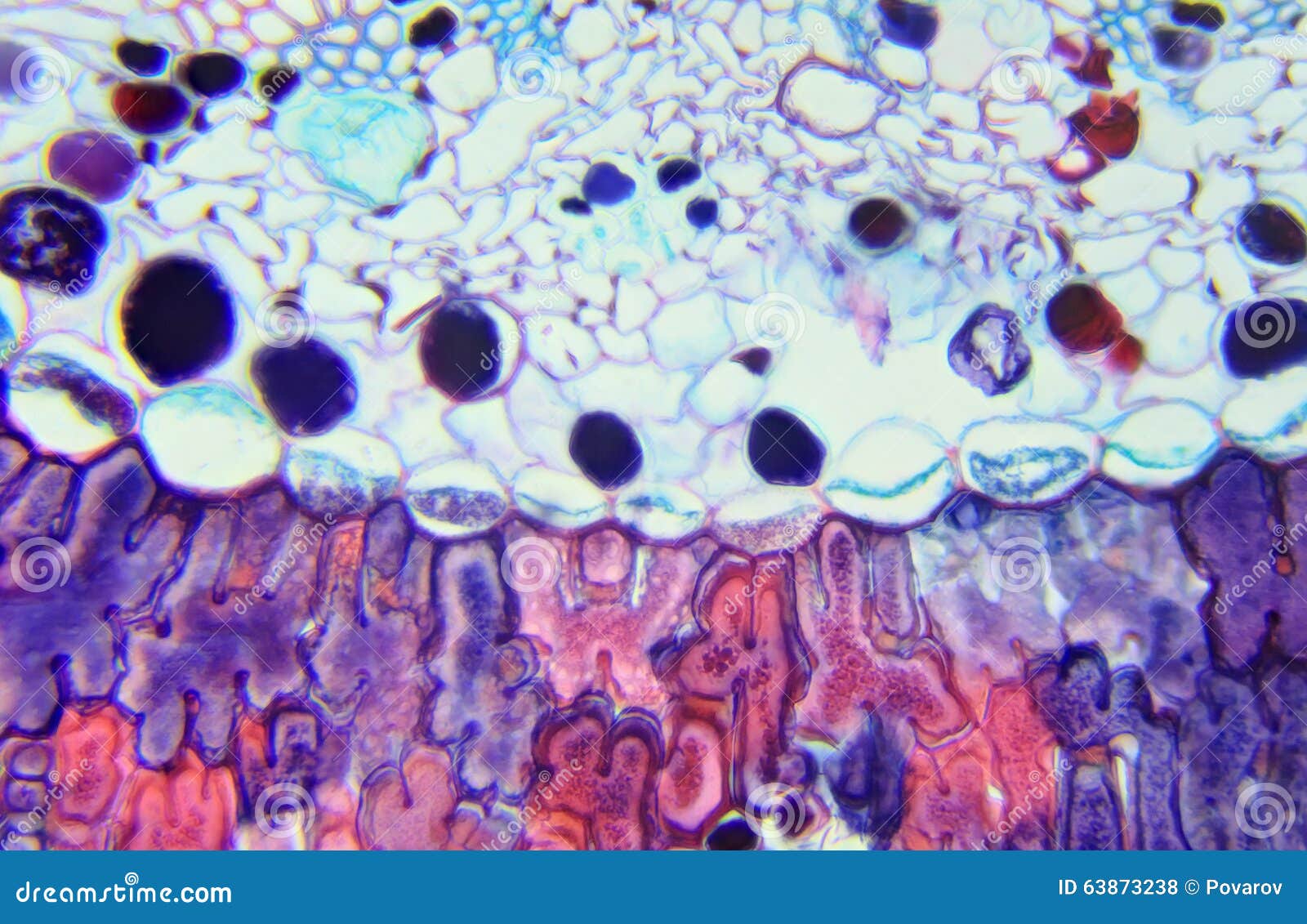 Pine Needle Cross-section Under The Microscope, Background Stock Photo ...