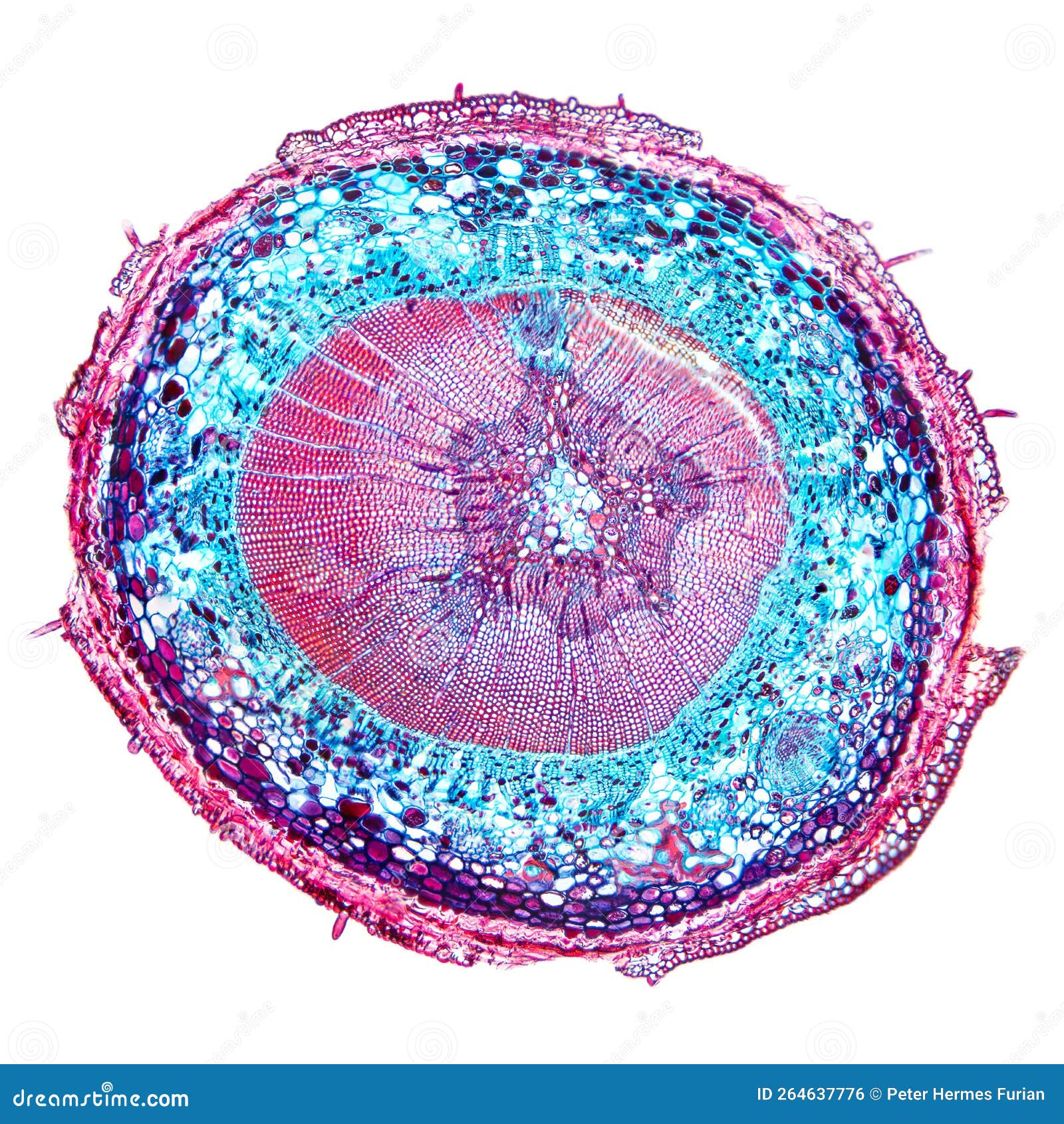 Light Micrograph Of Human Brain Tissue Royalty-Free Stock Photography ...