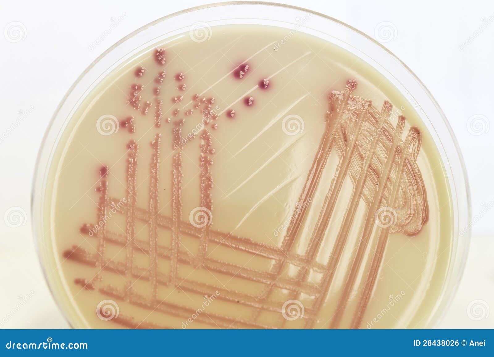 Pink Bacterial Culture on Colorless Colored Agar Stock Photo - Image of ...