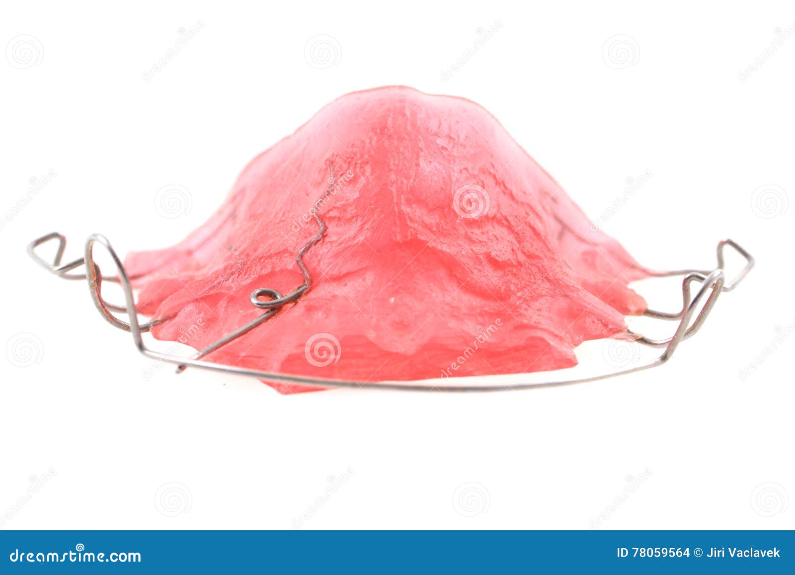 Pink braces isolated stock photo. Image of correction - 78059564