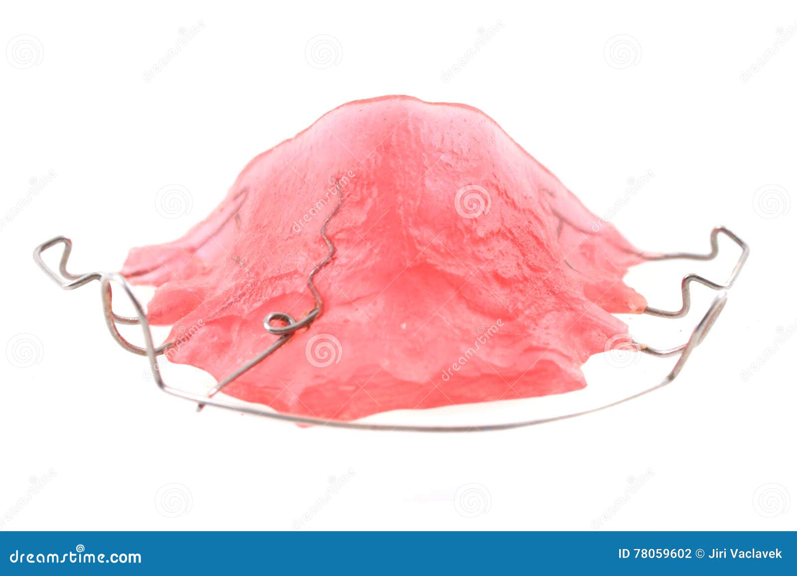 Pink braces isolated stock photo. Image of plastic, treatment - 78059602