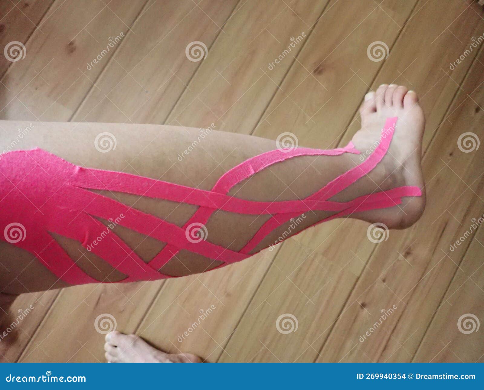 Lymfatic Tape on a Leg after Operation Stock Photo - Image of health ...