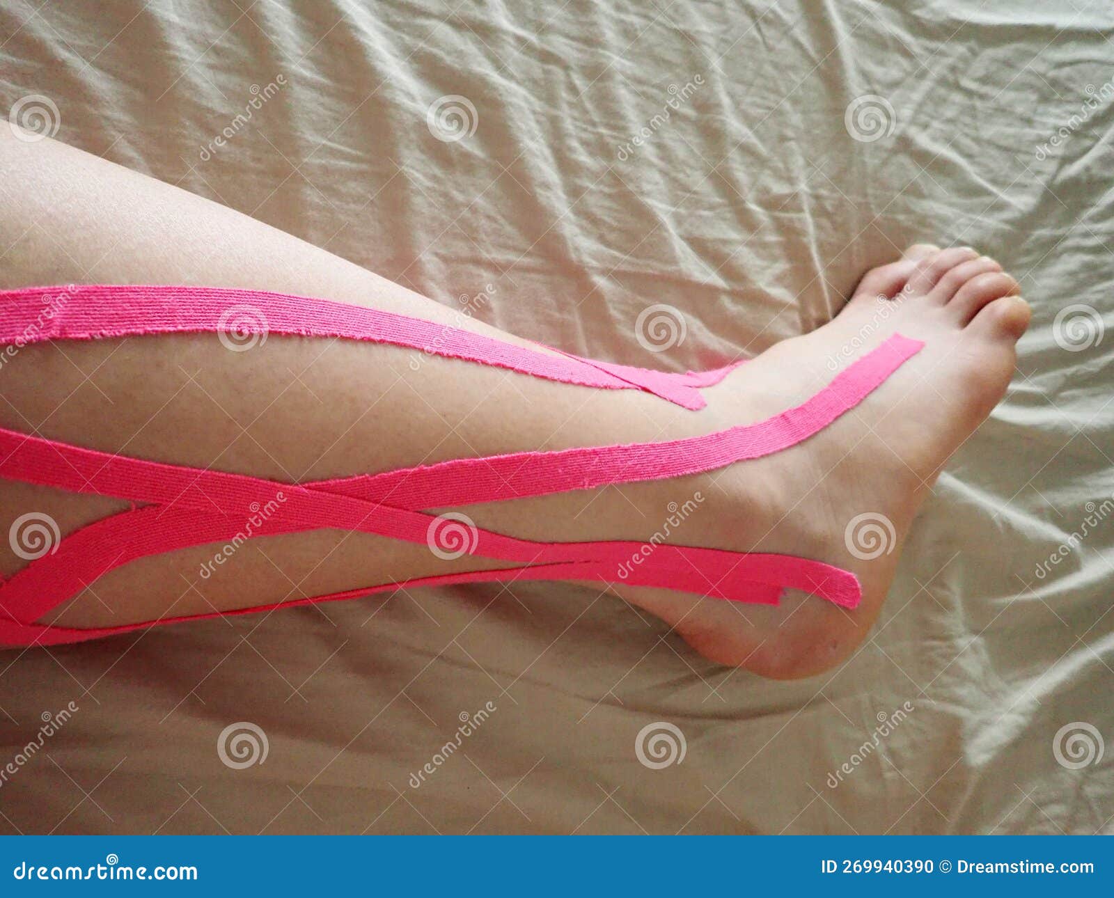 Lymfatic Tape on a Leg after Operation Stock Photo - Image of massage ...