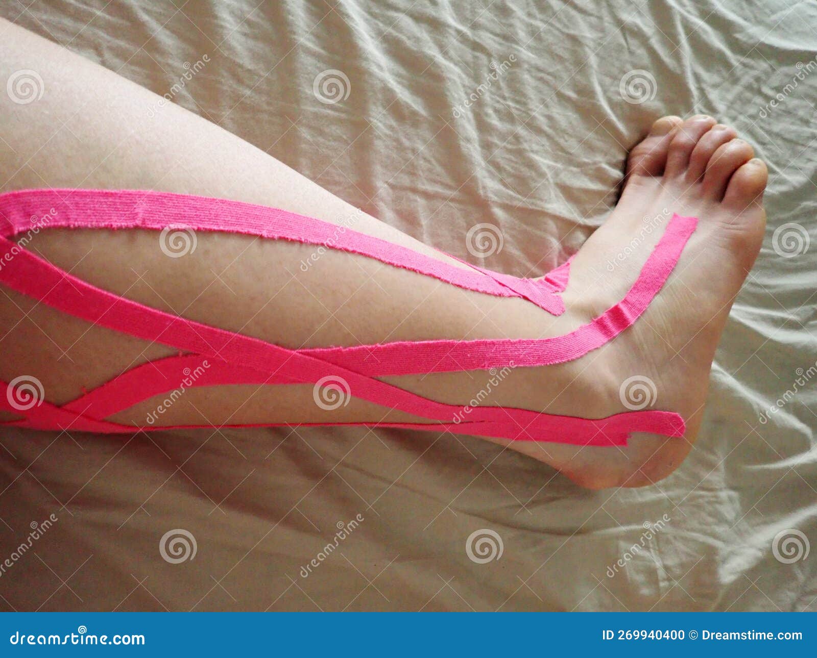 Lymfatic Tape on a Leg after Operation Stock Photo - Image of physio ...