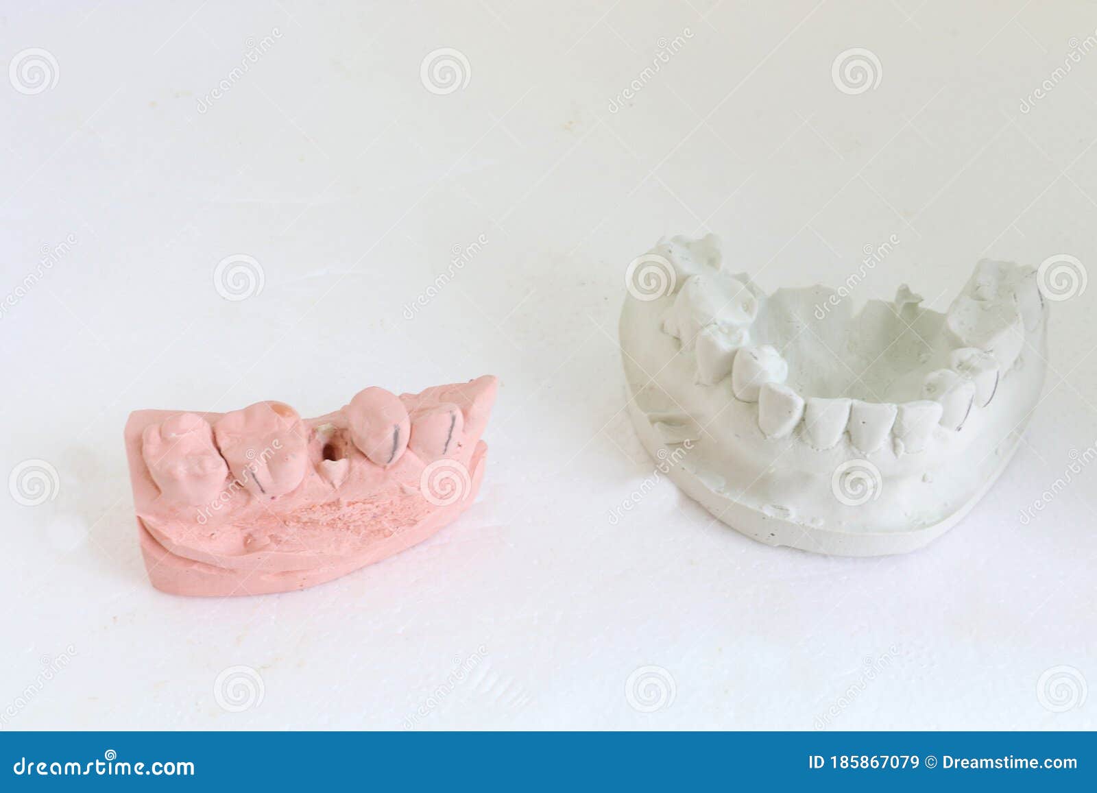 Pink and White Plaster Impression of Lower Teeth Isolated on White ...