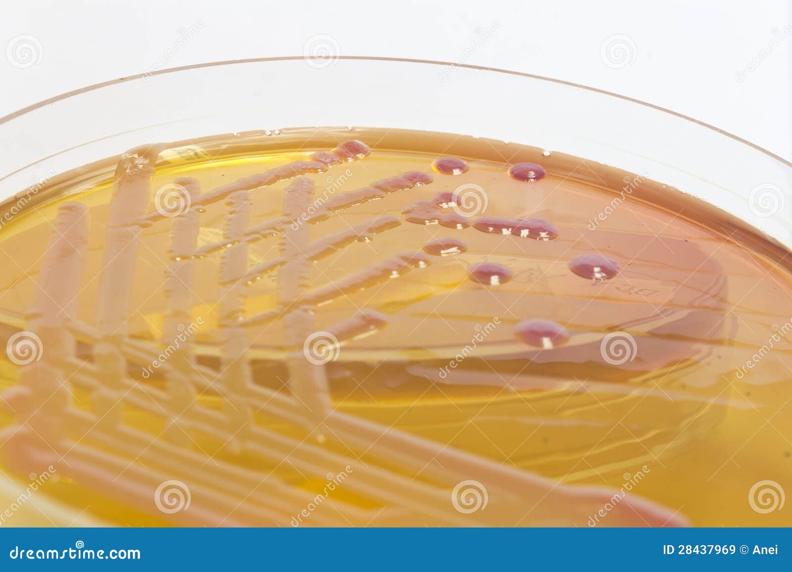 Pink and Yellow Bacterial Culture on Agar - Sideview Stock Image ...