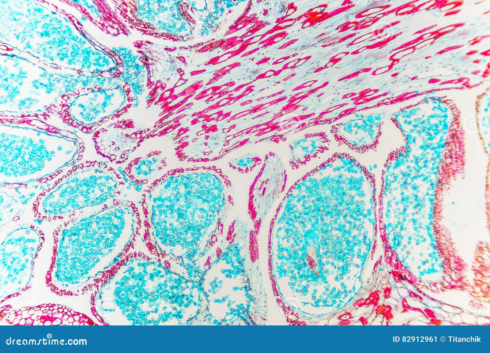 Pinus Male Strobile- Cell Microscopic Stock Image - Image of cross ...