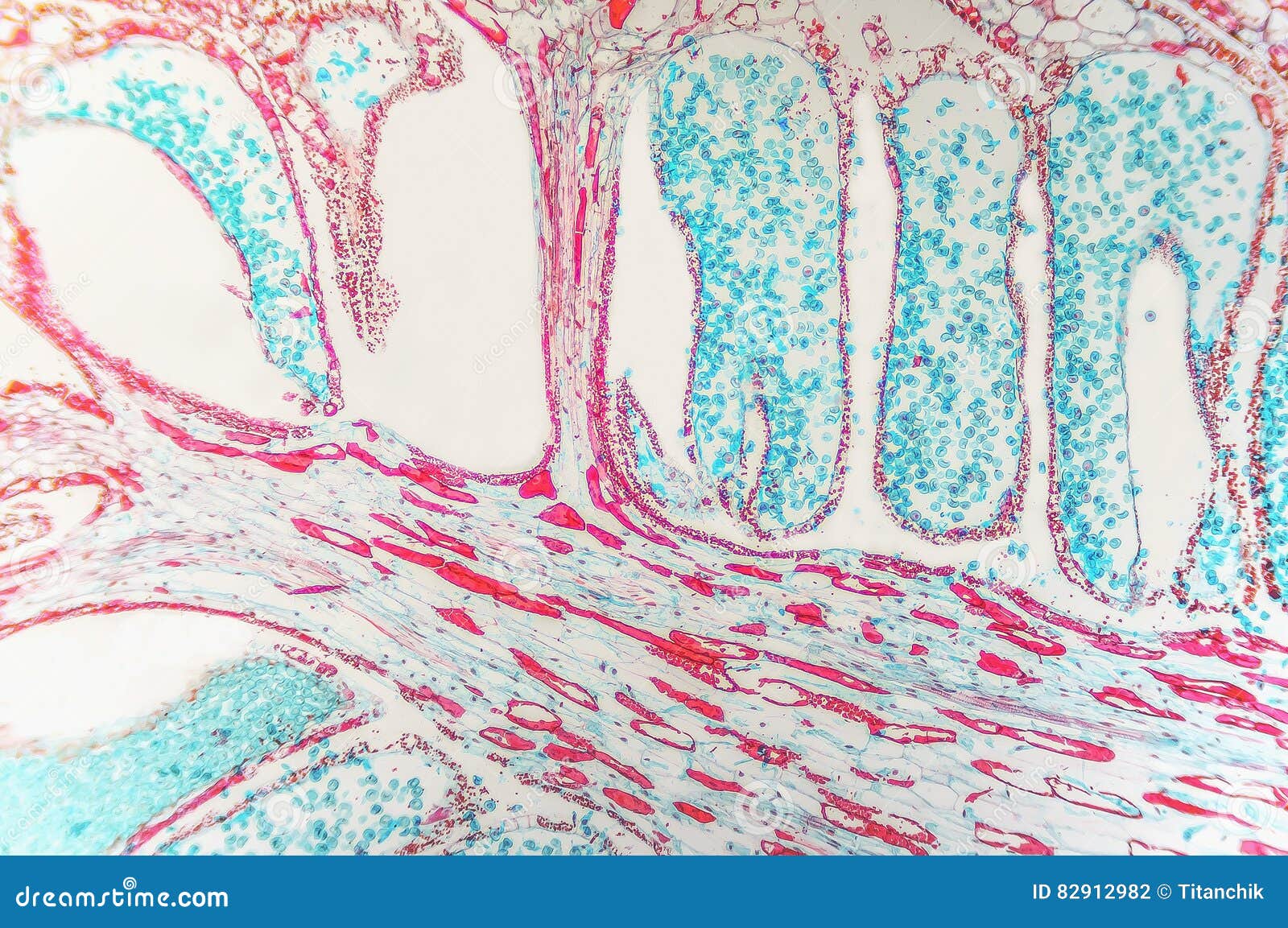 Pinus Male Strobile- Cell Microscopic Stock Photo - Image of cross ...