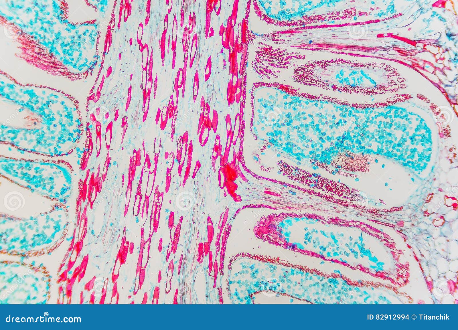 Pinus Male Strobile- Cell Microscopic Stock Photo - Image of ...