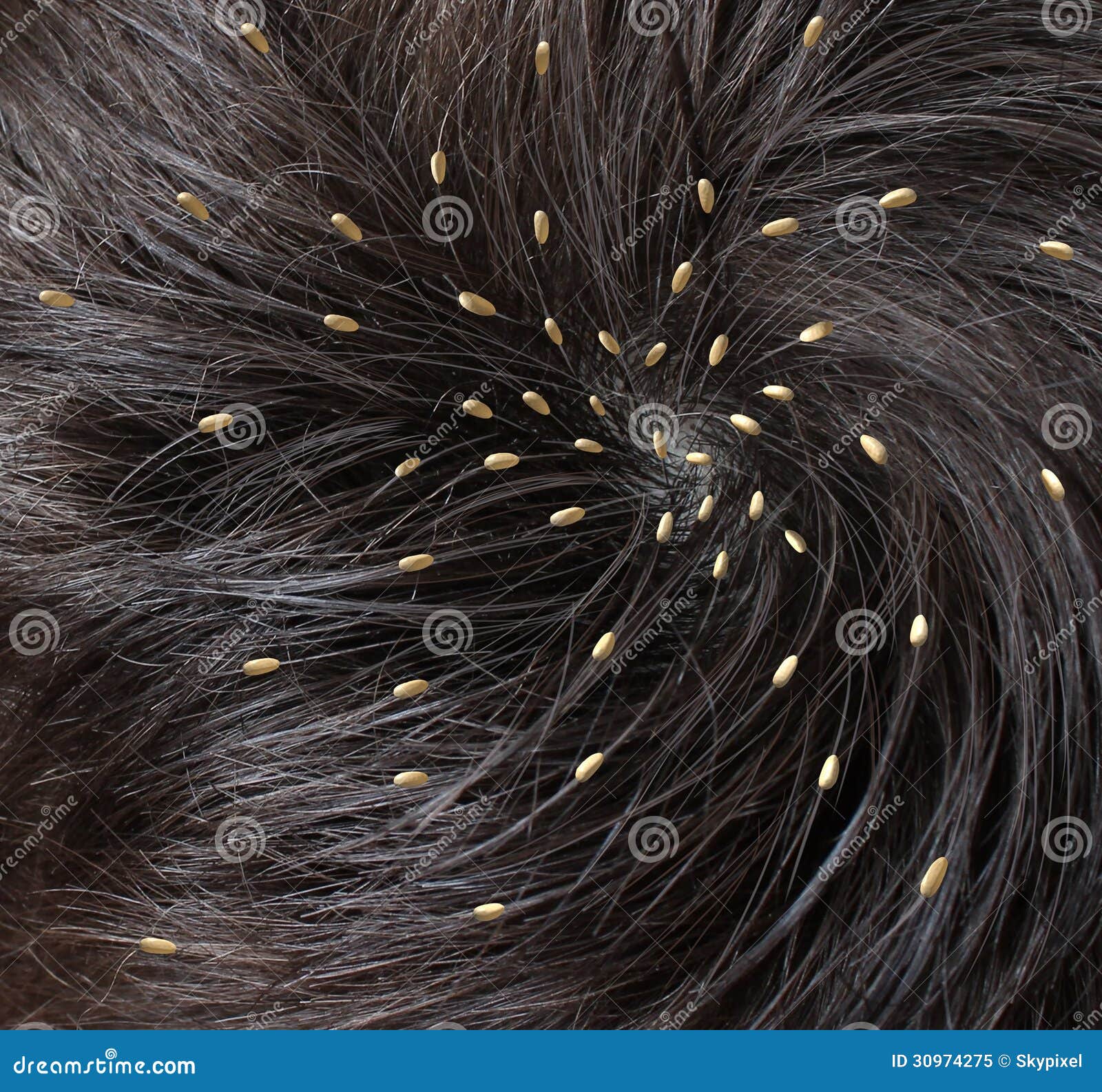 Piolhos Principais Foto de Stock Royalty Free - Imagem: 30974275