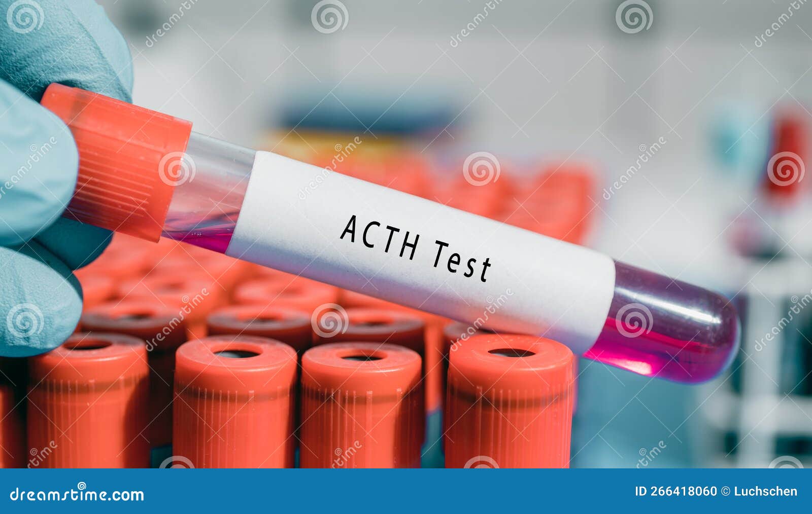 Pituitary Gland Adrenocorticotropic Hormone Acth Test Controls