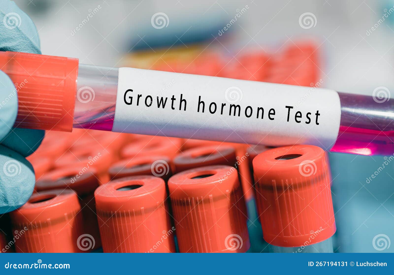 Pituitary Gland Growth Hormone GH Test Affects Growth and Development ...