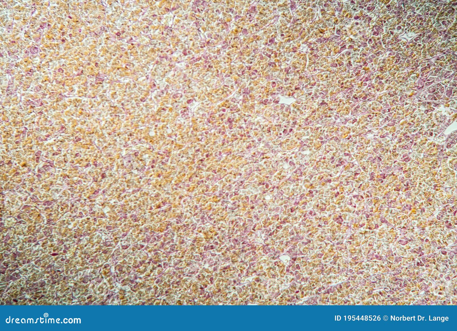 Pituitary Gland Under the Microscope Stock Photo - Image of science ...