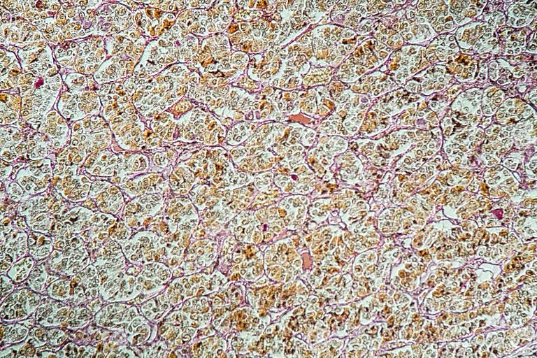 Pituitary Gland Under the Microscope Stock Photo - Image of gland ...