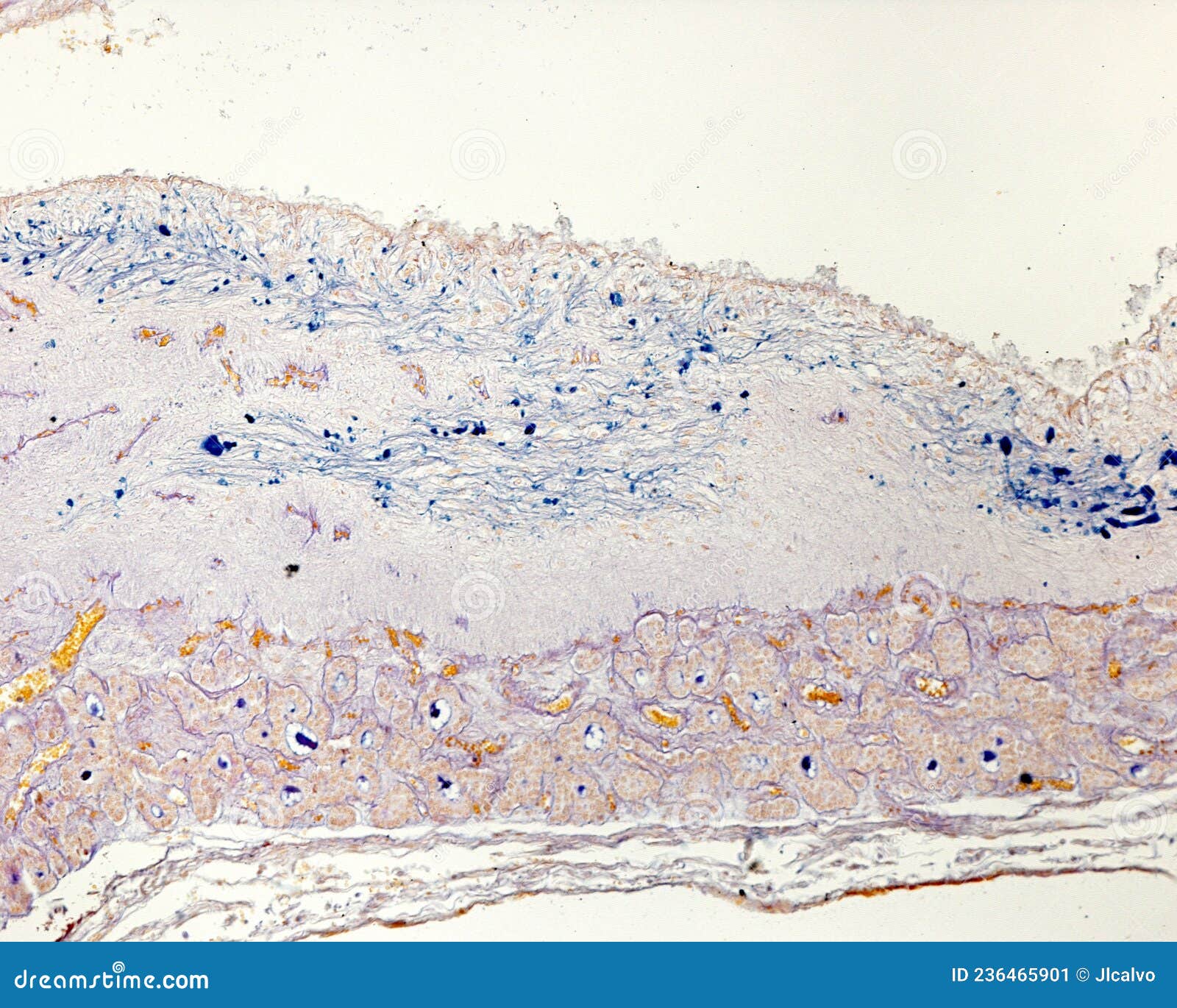 Pituitary Stalk. Neurosecretion Stock Image - Image of hypophysis ...