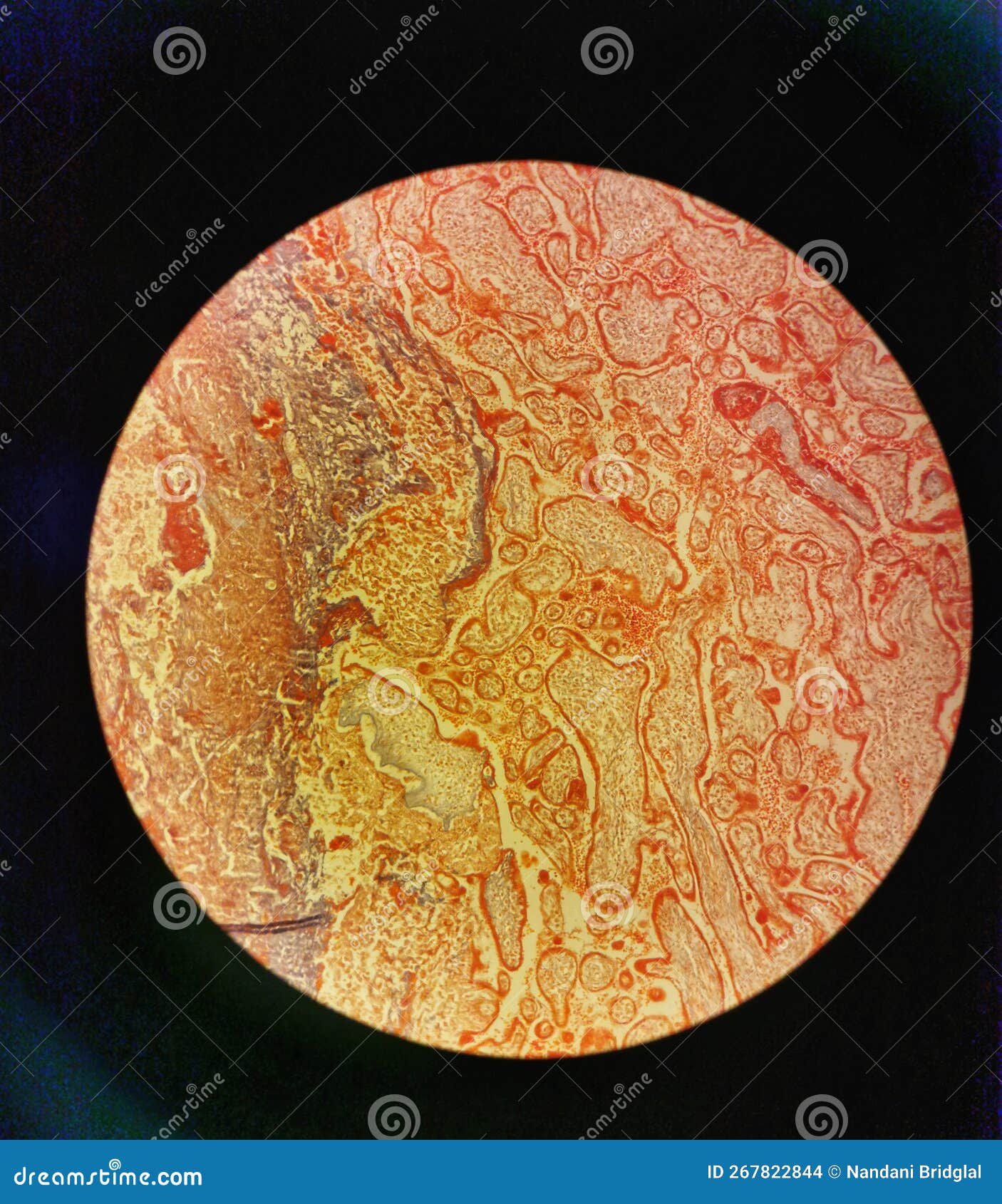 Placenta Cross-section stock photo. Image of pregnancy - 267822844