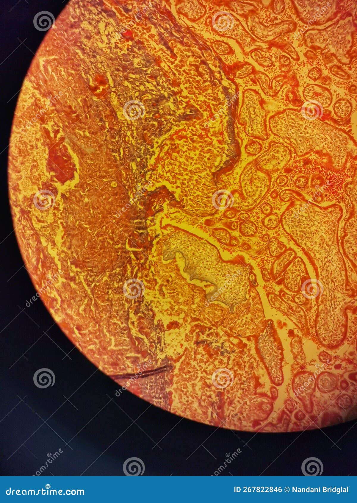 Placenta Cross-section stock photo. Image of gynecological - 267822846