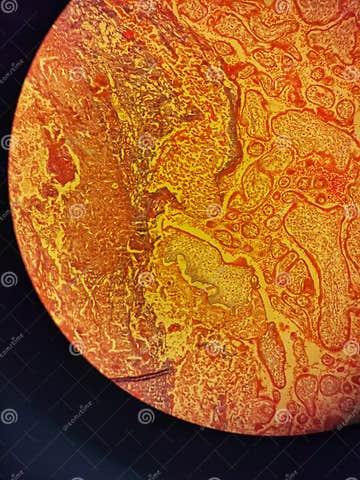 Placenta Cross-section stock photo. Image of gynecological - 267822846