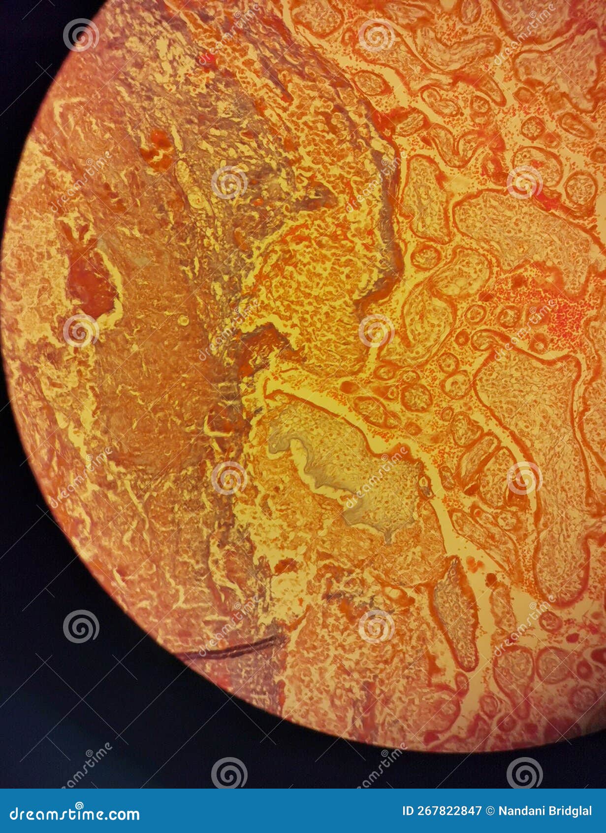 Placenta Cross-section stock image. Image of animal - 267822847