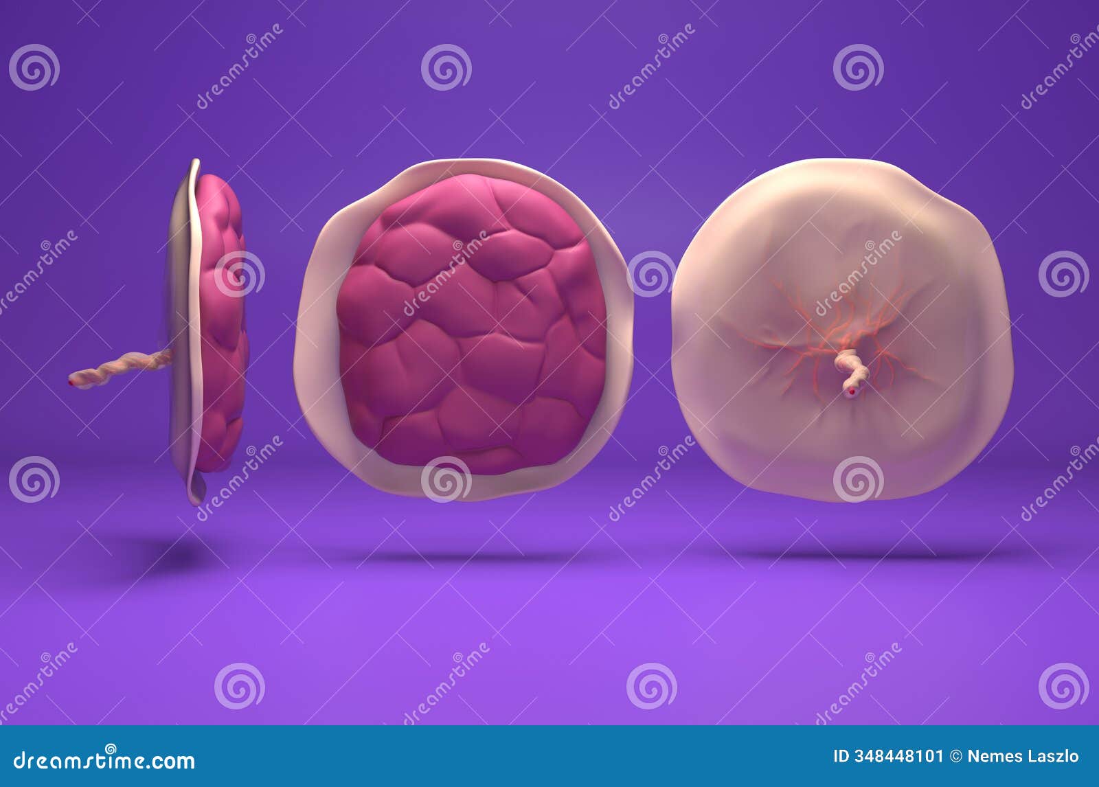 Placenta - Isometric View 3d Illustration Stock Illustration ...