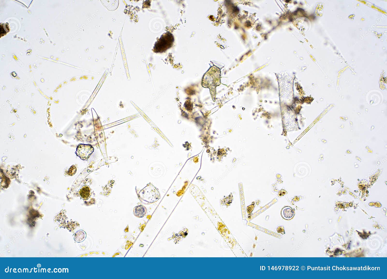 Plancton Aquatique Marin Sous La Vue De Microscope Photo stock - Image ...