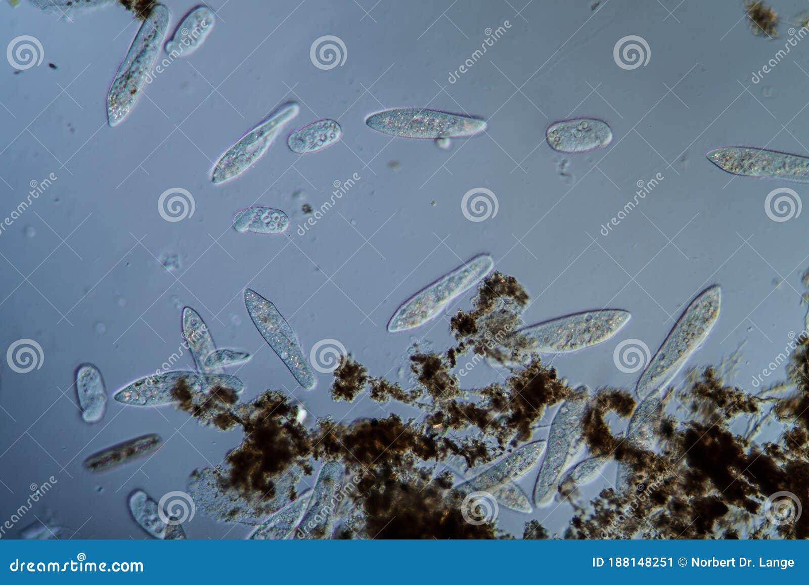 Plankton with Microscopic Ciliates Stock Image - Image of microscopic ...
