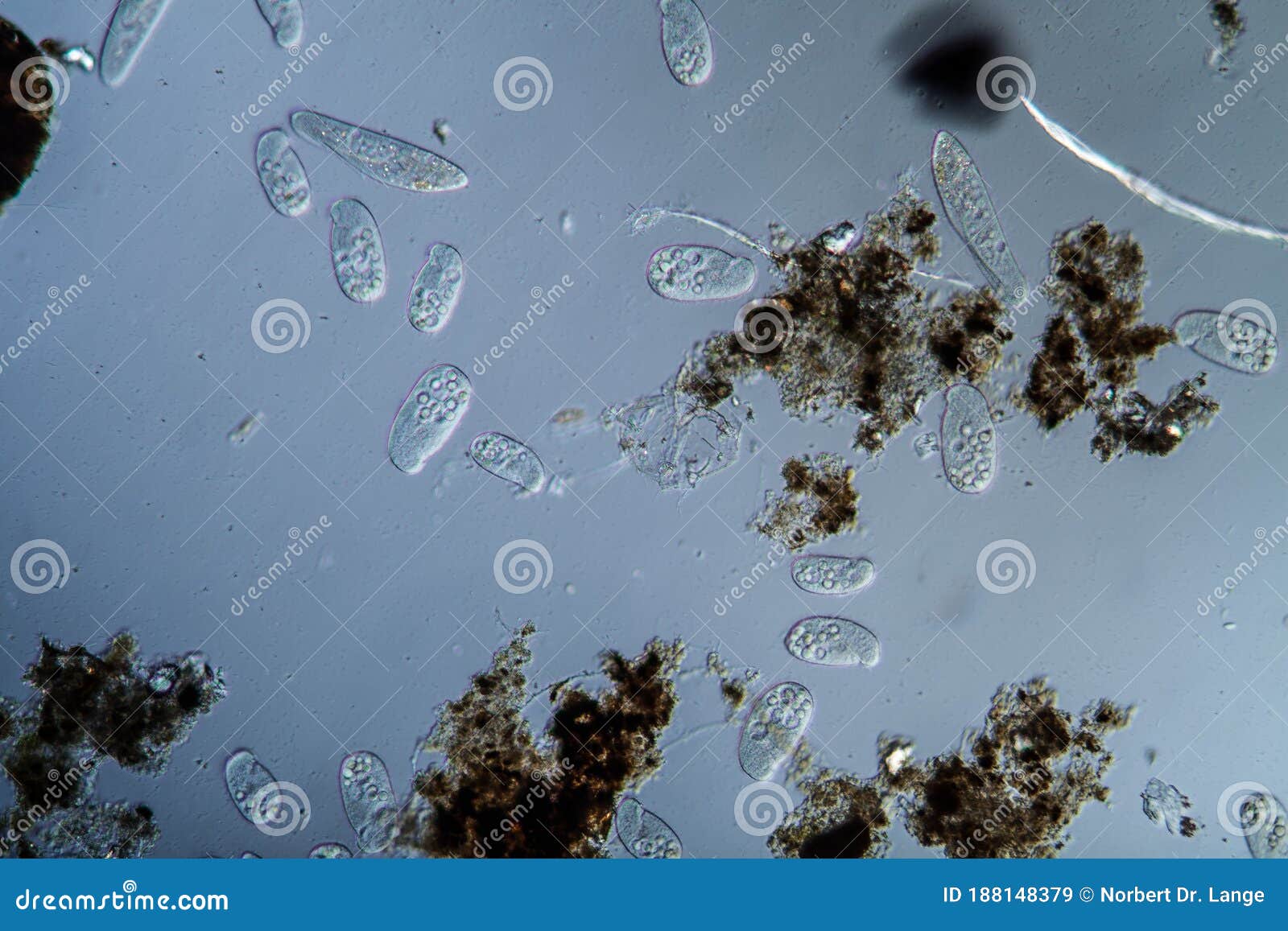 Plankton with Microscopic Ciliates Stock Image - Image of protozoa ...