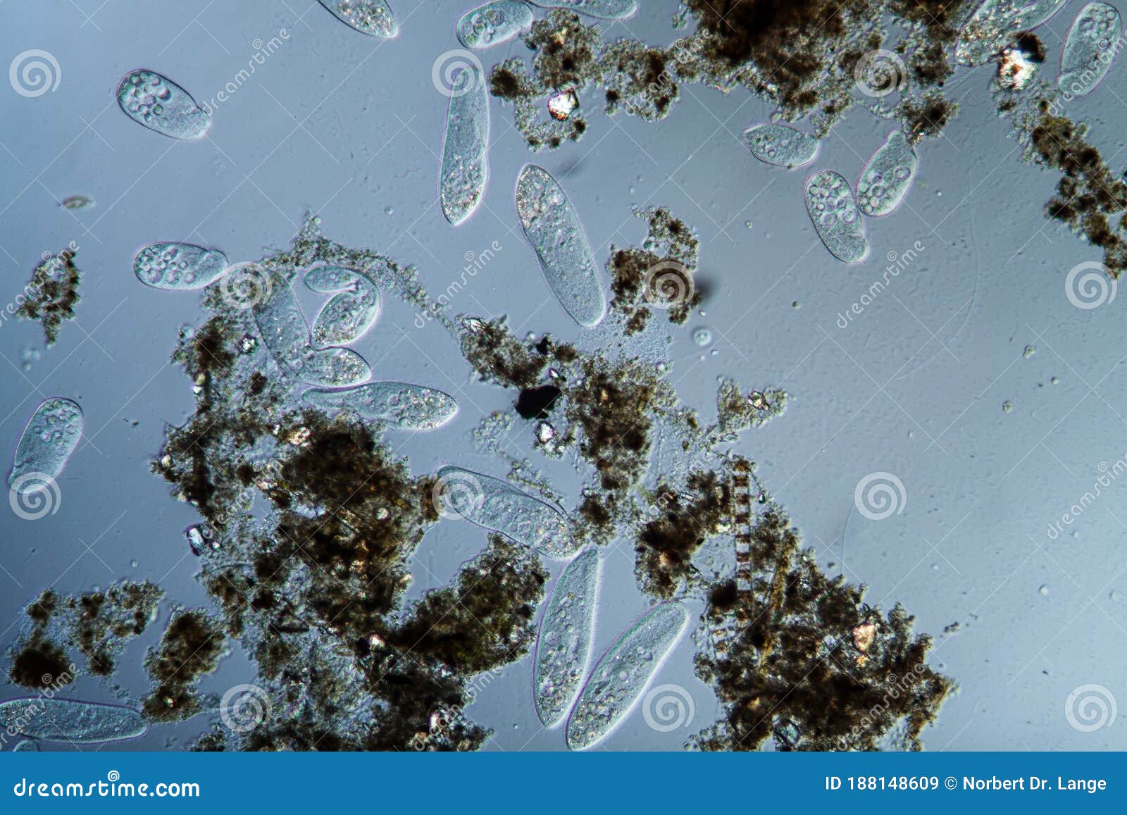 Plankton with Microscopic Ciliates Stock Image - Image of plankton ...