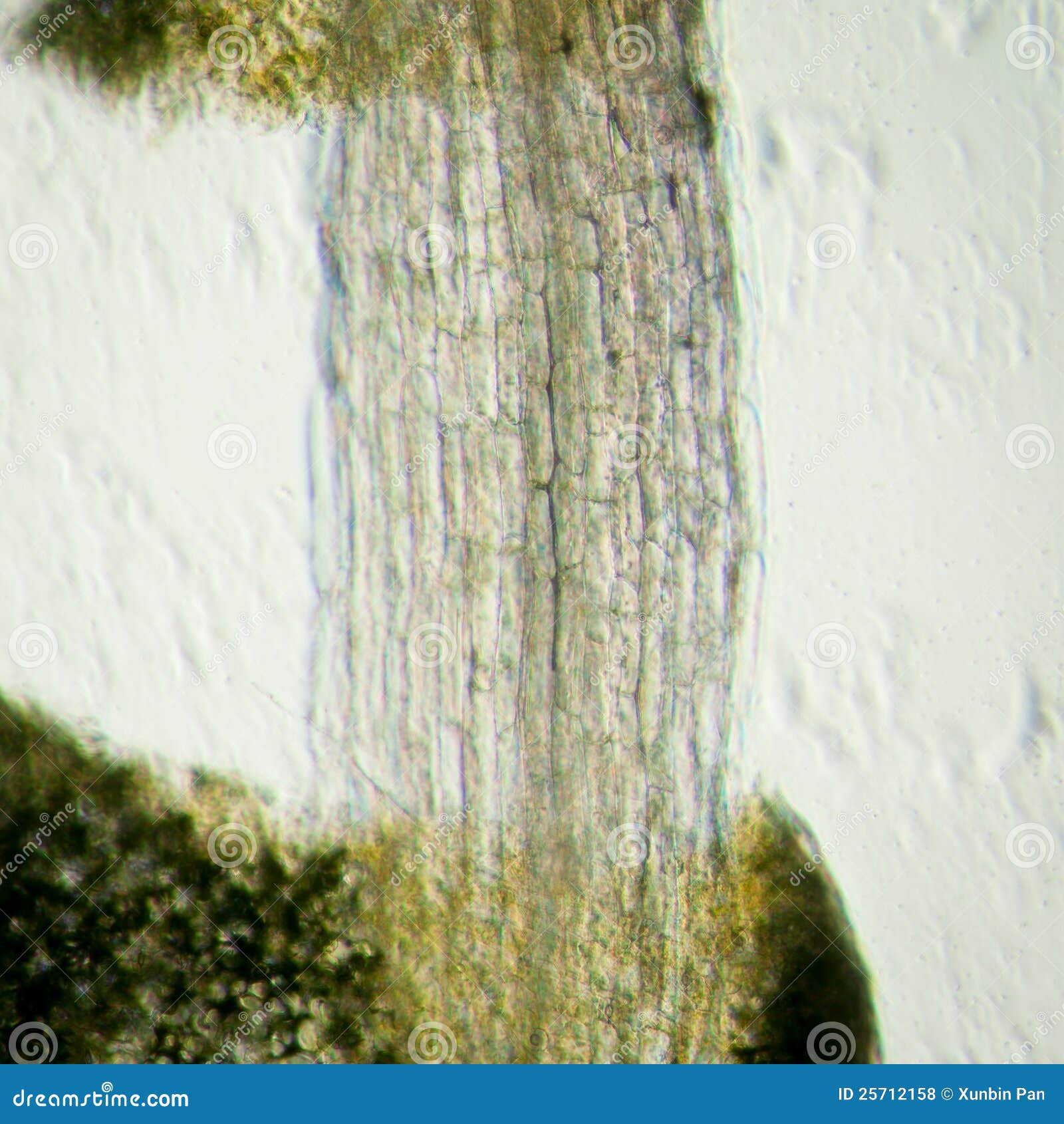 Plant Arabidopsis Thaliana Root Stock Photo - Image of magnification ...