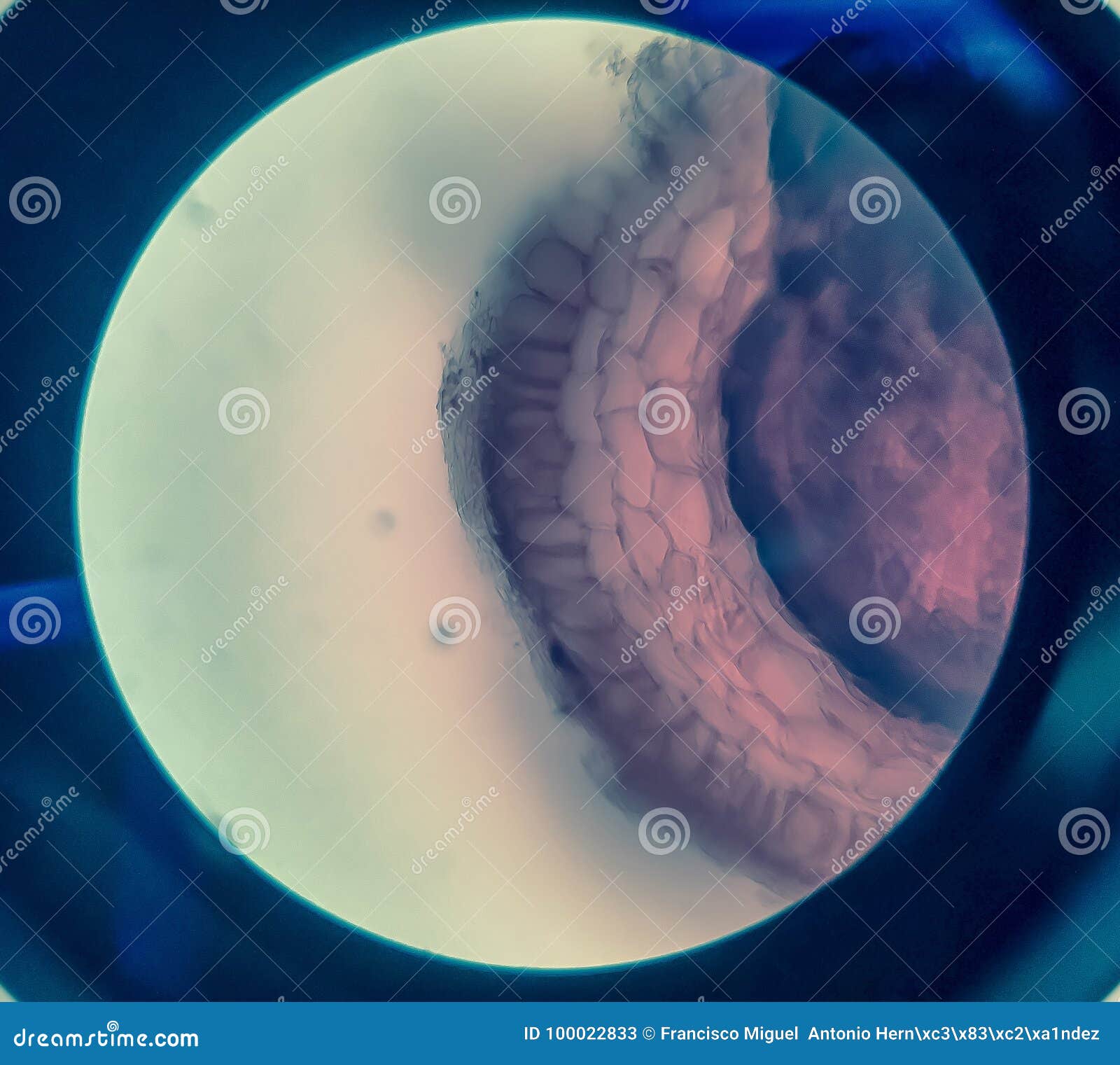 Plant cells stock image. Image of microscope, cacopy - 100022833