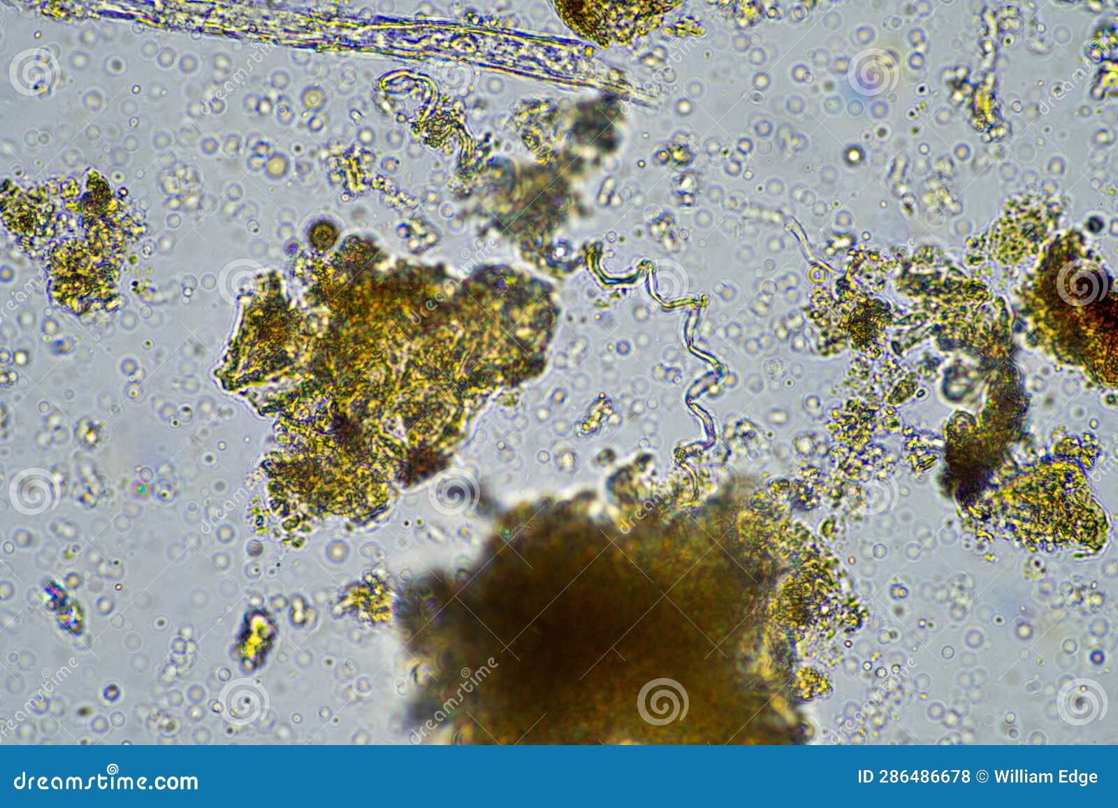 Plant Cellulose in a Soil Sample Under the Microscope Stock Photo ...