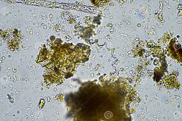 Plant Cellulose in a Soil Sample Under the Microscope Stock Image ...