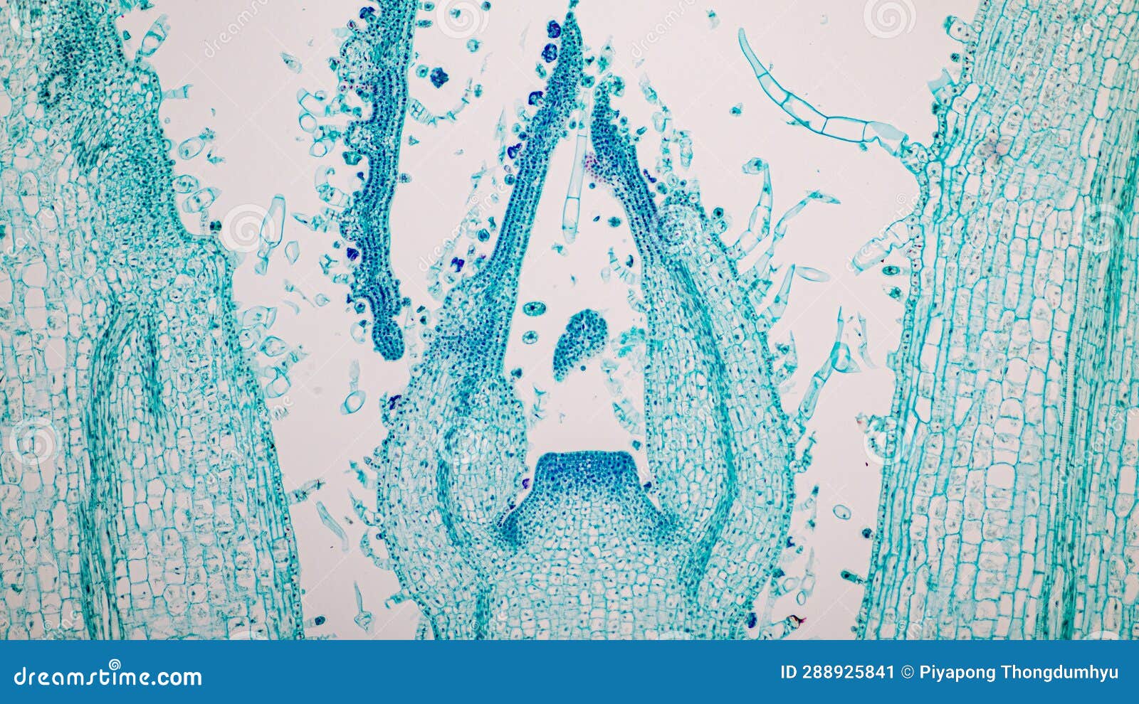 Plant Tissues Under the Microscope in the Laboratory. Stock Image ...