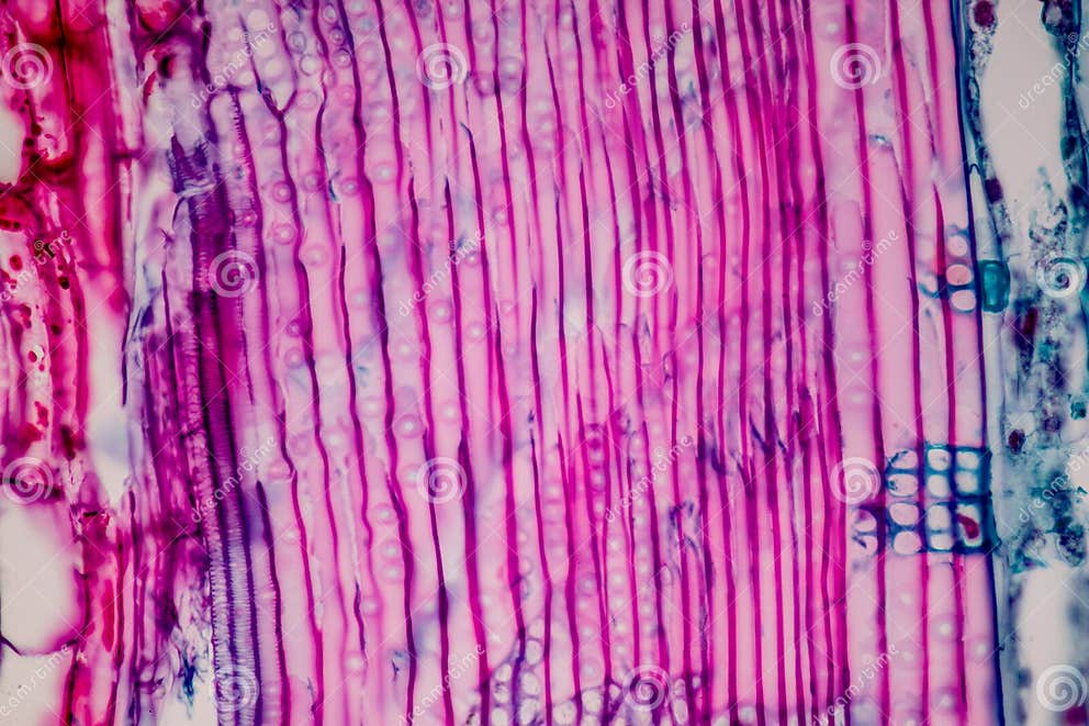 Plant Tissues Under the Microscope in the Laboratory. Stock Image ...